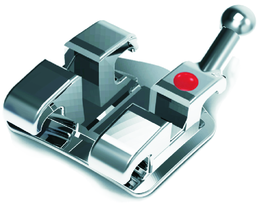 Brackets en métal - NWO - NEW-ORTHO